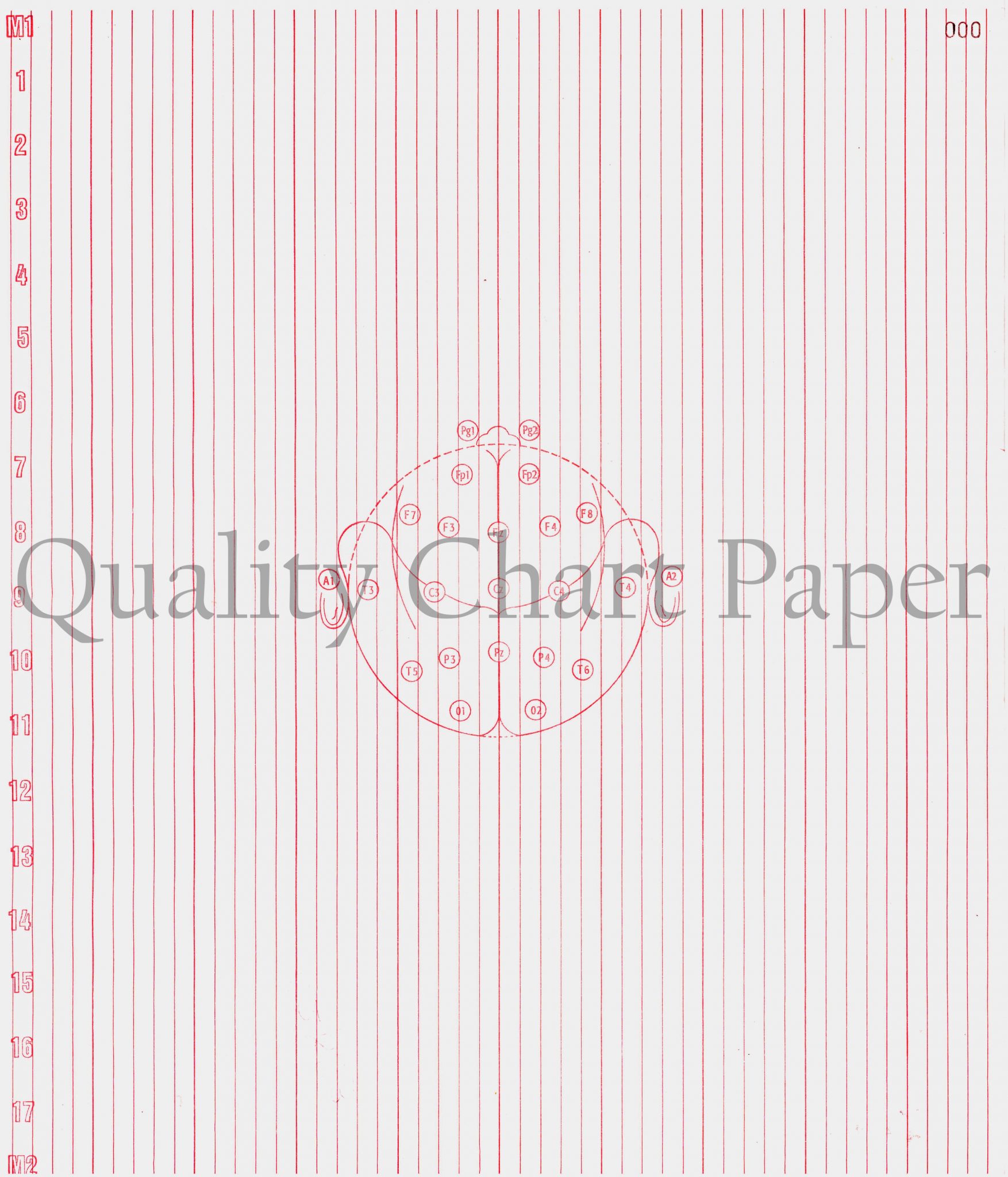 EEG Paper NICOLET 1A97 345MM X 300MM X 1000SH - Quality Chart Paper ...